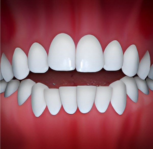 Common Orthodontic Problems | Greco Orthodontics Mercerville