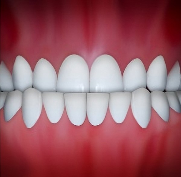 Common Orthodontic Problems | Greco Orthodontics Mercerville